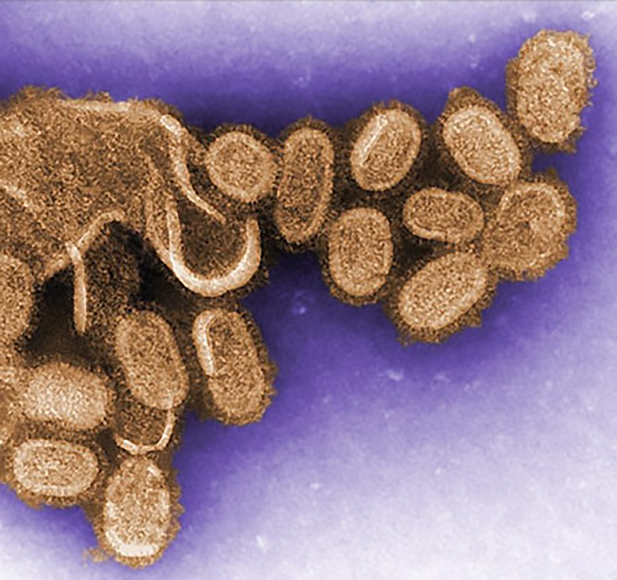 Molecular Pathogen Panels In Beaker Ehr Optimization 3196